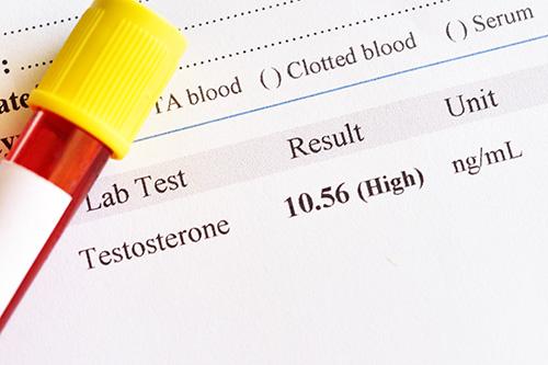 What is testosterone? Understanding your testosterone levels.