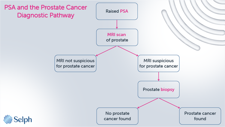 ‘PSA test - what you need to know