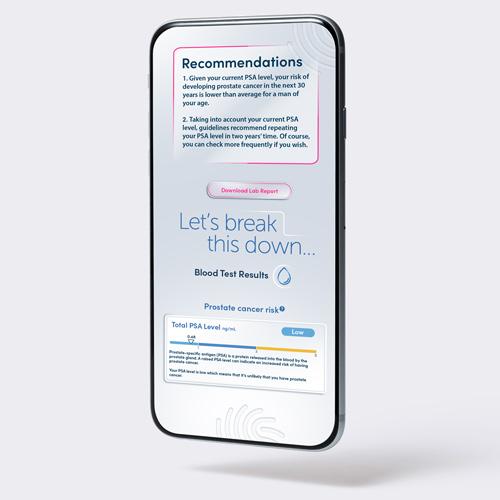 Prostate Specific Antigen (PSA) Blood Test